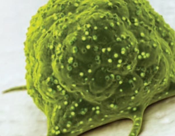 Modeling and Simulation Supports Post-approval Commitment in Oncology ...